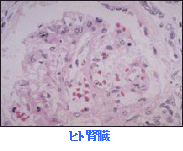 ワイゲルト鉄ヘマトキシリン染色セット・Weigert's Iron Hematoxylin Staining Set・298-21741【詳細情報】｜試薬-富士フイルム和光純薬